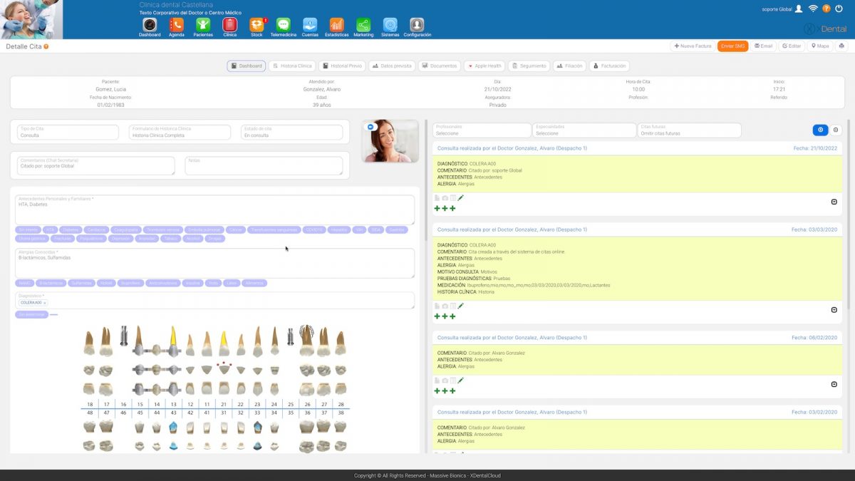 Odontograma Dental: Qué Es y Cómo Hacerlo con Ejemplos